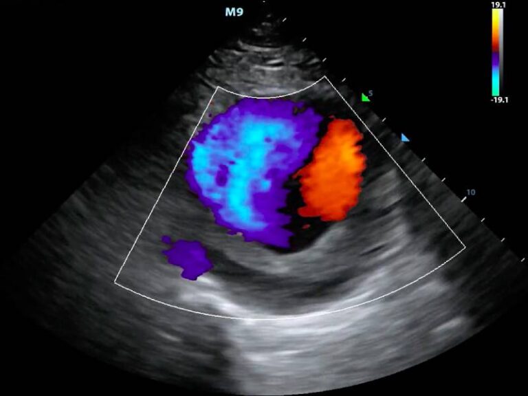 Colour Doppler Megavision Diagnostics Centers